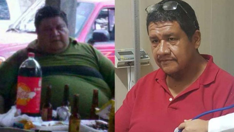 Logró bajar 91 kilos en 3 años - Periódico AM